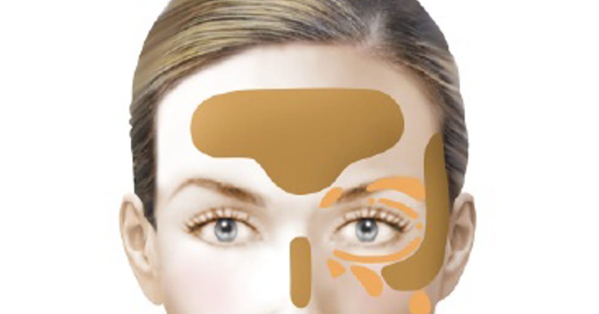 dermolipectomie france - France | about.me