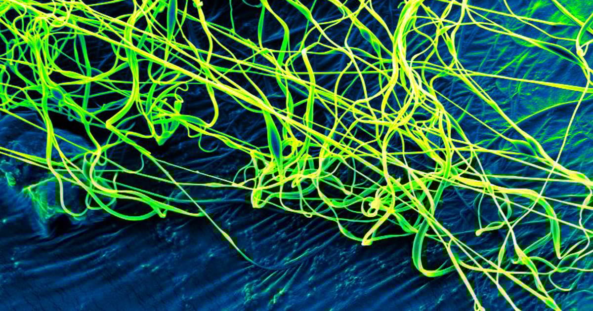 Jennifer Atchison - Saarbrücken, Germany, Drexel University | about.me