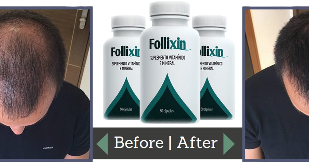 Follixin Hairgrowth - Brazil | about.me