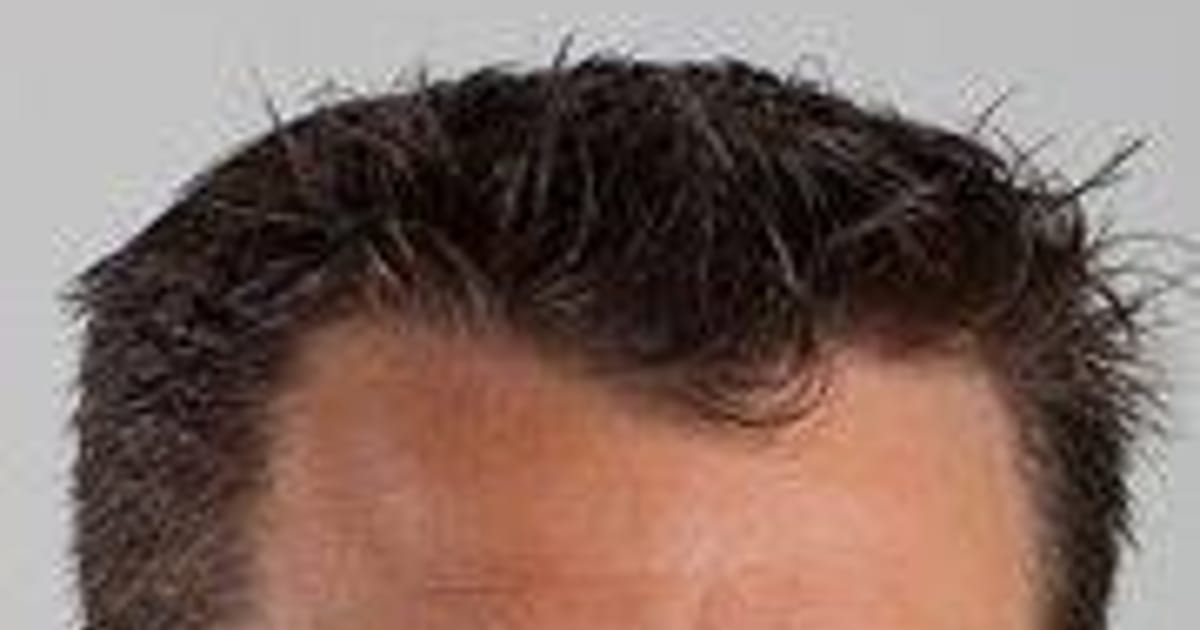 Michael Nägeli - Romanshorn, Switzerland, Münsterlingen, Switzerland ...